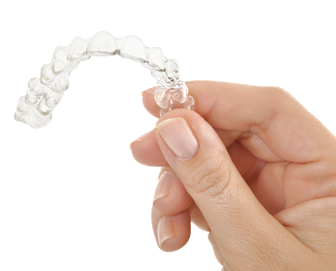 The Dangers of Ordering Aligners or Clear Braces Online - Dentist in ...